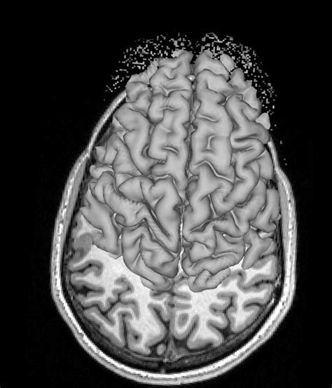 Surface Based Analysis For Neocortex Diedrichsen Lab