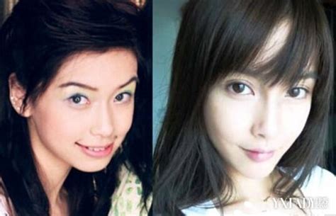 图杨颖angelababy整容前后照片 变美or整残 2 angelababy整容前后照片 伊秀美容网 yxlady