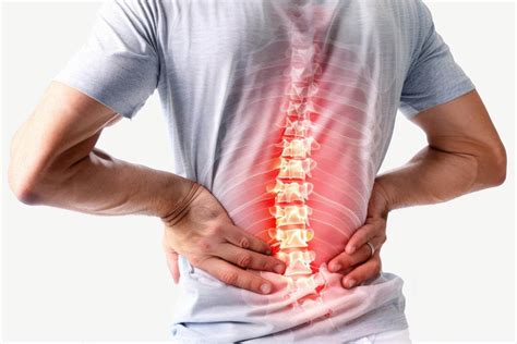 Is Dry Needling An Effective Treatment For Sciatica