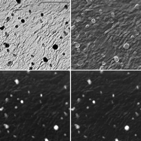 Stem Detector In Sem A Bse Detector Is Positioned Below The Sample Download Scientific Diagram