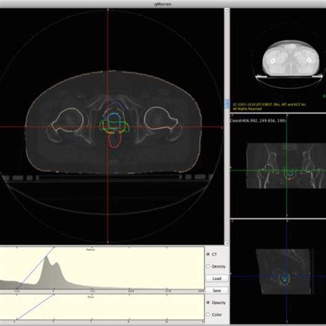 roi images constructed from a dicom rt structure set file the roi
