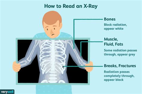 X Ray Chart Definition At Katie Jenkins Blog