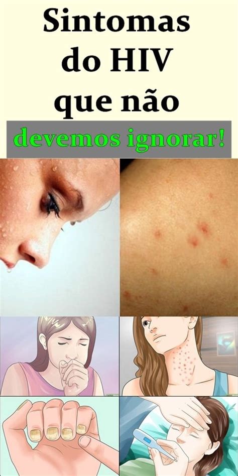 Vih Sida Sintomas