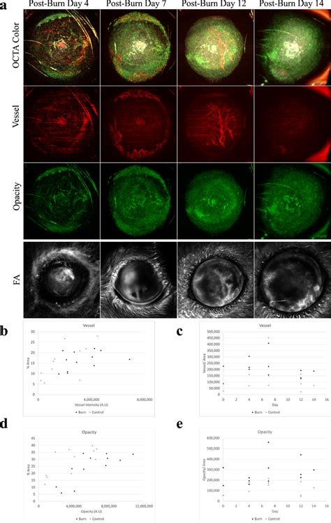 A The Octa And Fa Data Show Neovascularization Progression Over Time