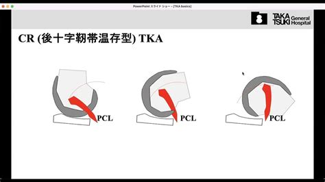 Type Of Tka Cr Ps Cs In Japanese Youtube