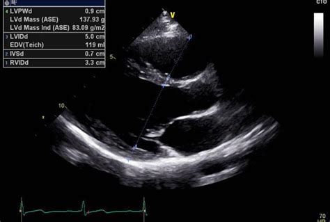 GC CVT Echo Visual Protocol