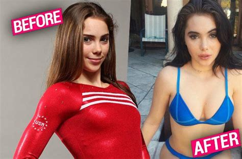 Olympic Gymnasts Secret Plastic Surgery Top Docs Believe Mckayla