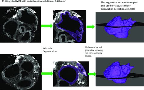The Segmentation Of The High Resolution T1 Weighted Mri Used For The Download Scientific