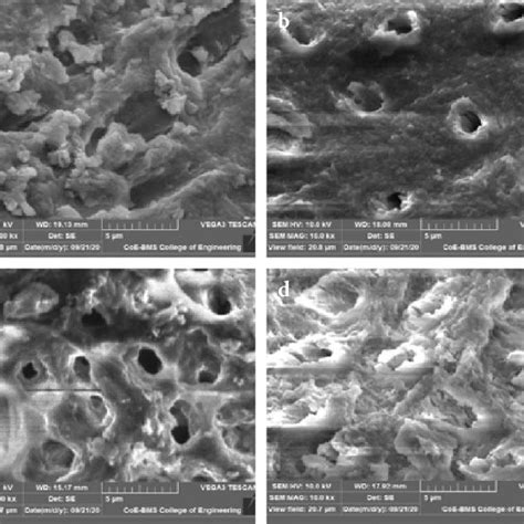 Pdf Scanning Electron Microscopic Evaluation Of Residual Dentin Surface In Primary Teeth After