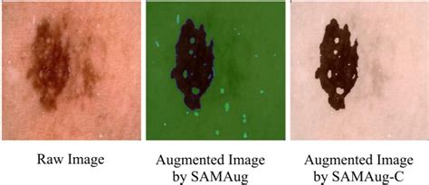 [论文审查] Boosting Medical Image Classification With Segmentation Foundation Model