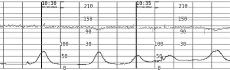 Course 4 Nichd Definitions Obix Poet