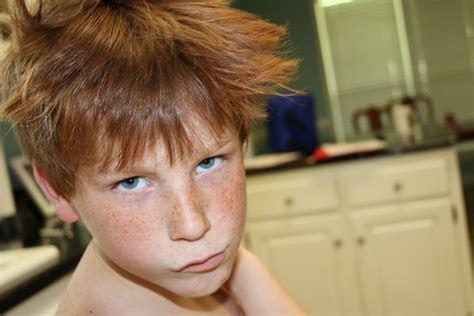 Pin By Melissa Considine On Red Hair And Freckles Freckle Face Red