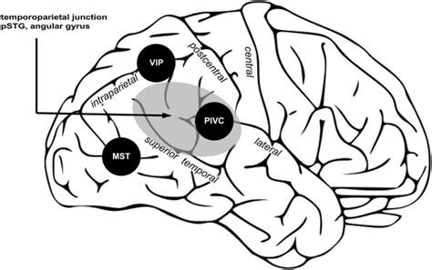Three Posterior Cortical Regions Processing Vestibular Signals Are Download Scientific Diagram