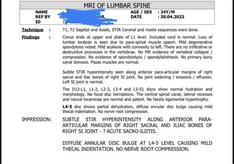 Mri Of Spine Do You Think I Have Sciatica Rsciatica