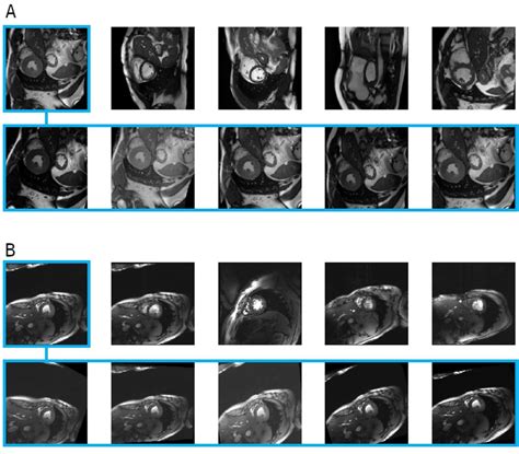 Figure 3 From A Deep Learning Based Cardiac Cine Segmentation Framework 1 For Clinicians