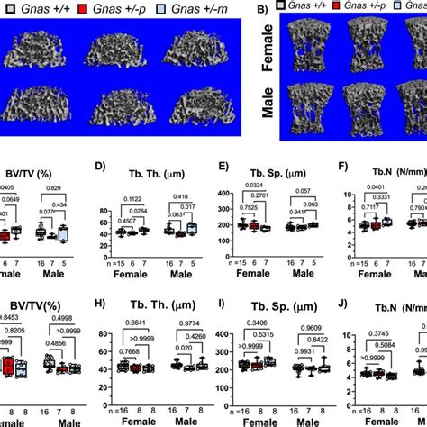 Femur And Vertebral Trabecular Bone Parameters Are Mildly Influenced By