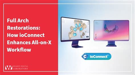 How Ioconnect Enhances All On X Workflow Wiand Dental Lab