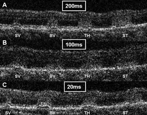Horizontal Fourier Domain Optical Coherence Tomography Scans At 1 Hour Download Scientific