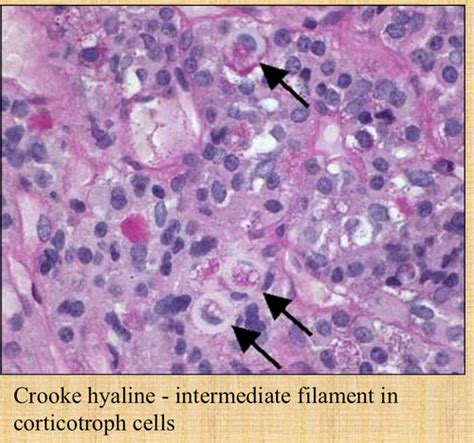 Endocrine Flashcards Quizlet