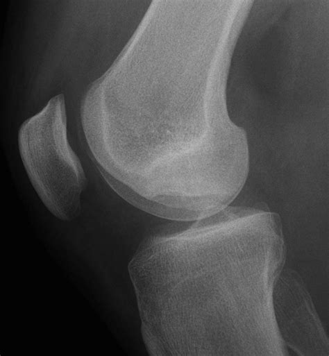 Background The Bone School