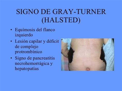 Semiologia Gastrointestinal