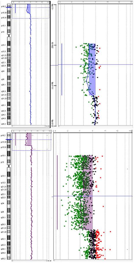 a a cgh profile of chromosome 4 showing an terminal deletion to the download scientific