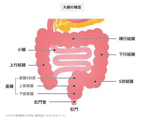 大腸がんの腹膜播種とは 進行と症状について メディカルノート