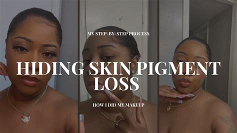 Makeup Tutorial How I Covered My Hypopigmentation With A Few Makeup