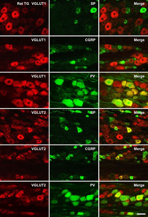 Double Immunofluorescent Staining For Vglut Red And Neuropeptides Download Scientific Diagram