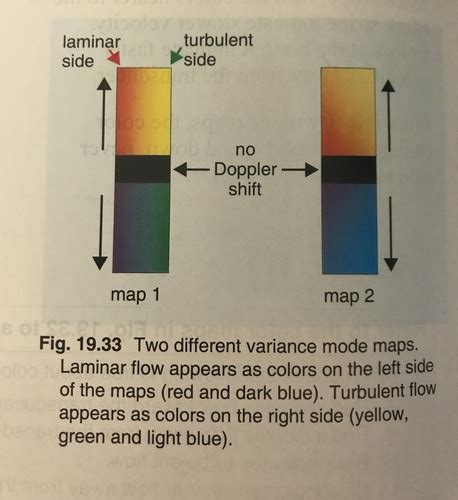 Ch 19 Doppler Flashcards Quizlet