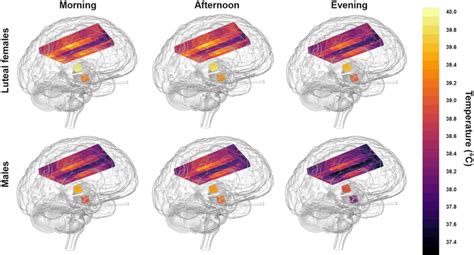 Healthy Human Brain Temperatur [image] Eurekalert Science News Releases
