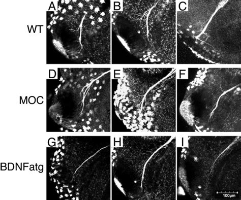 Decreased Axon Terminal Arborisation In Cement Glands Of Bdnf Download Scientific Diagram
