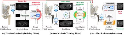 논문 리뷰 Reducing Ct Metal Artifacts By Learning Latent Space Alignment With Gemstone Spectral