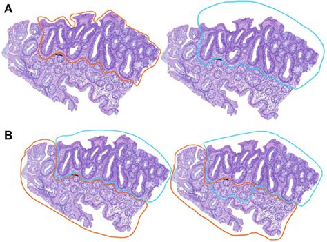 IMP Guidelines For Digital Annotation Published In The Modern Pathology Journal IMP Diagnostics