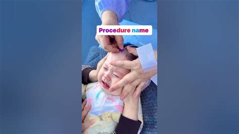 Procedure Name Youtube