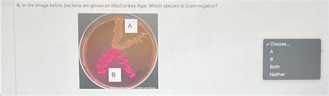 Solved In The Image Below Bacteria Are Grown On Macconkey
