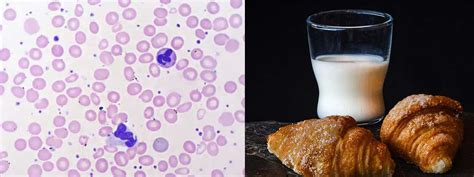 Quarter And Composite Sampling For Somatic Cell Count Test Scct