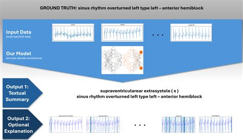 [논문 리뷰] Automated Medical Report Generation For Ecg Data Bridging Medical Text And Signal