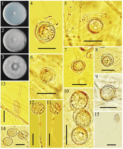 Pythium Sylvaticum Colony Morphology Of The Isolate OPU On CMA Download Scientific