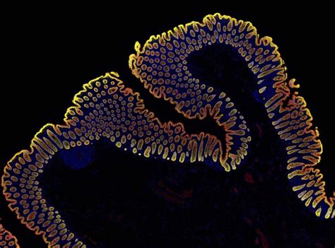 E Cadherin And β Catenin Interactions Navinci