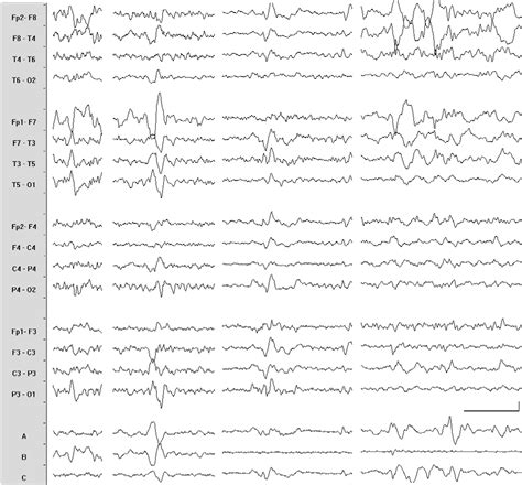 Figure 1 From How Wrong Can We Be The Effect Of Inaccurate Mark Up Of