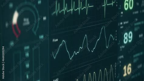 Medical Monitoring Dwindling Line Graph Shows Pulse Rate Decrease