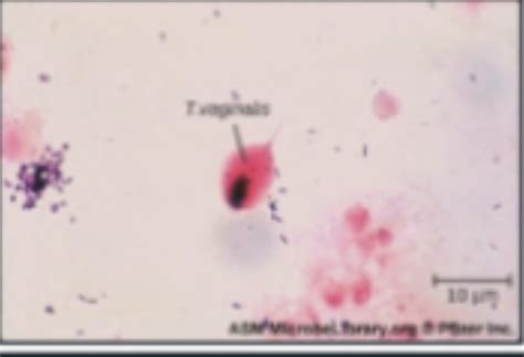 Lab 13 Protozoa Flashcards Quizlet