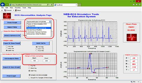 Figure 1 From Design Of A Web Laboratory Interface For Ecg Signal Analysis Using Matlab Builder