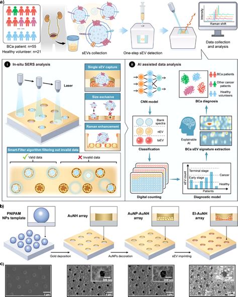 Schematic Illustration For The Non‐invasive Diagnosis Of Bladder Cancer