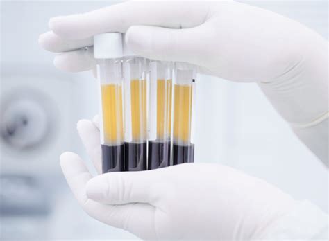 Koagulometre pre všetky typy laboratórií | BioVendor LM