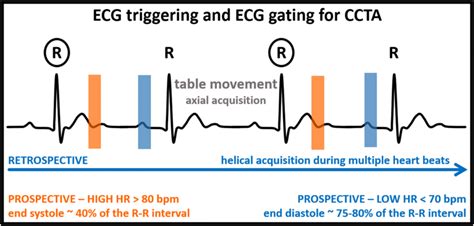 Ecg Triggering Is Used For Prospective Ccta Axial Acquisition The Download Scientific Diagram