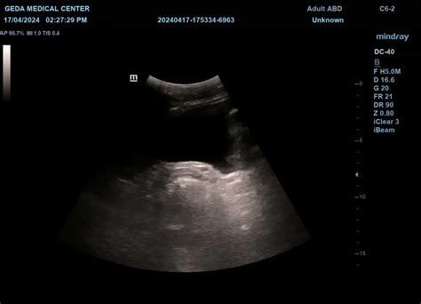 Mohammed Hamid On Linkedin This Is A Report I Organize For 38 Years Old Female Presenting With