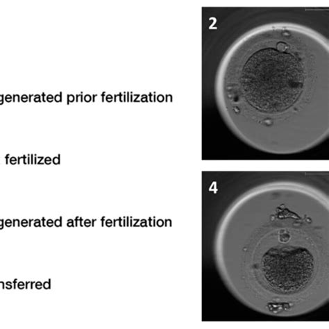 Classification Of Follicular Fluid Samples Follicular Fluids Ff Were
