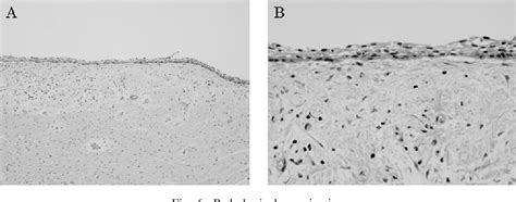 Figure 1 From Management Of The Malposition Tooth That Was Caused By